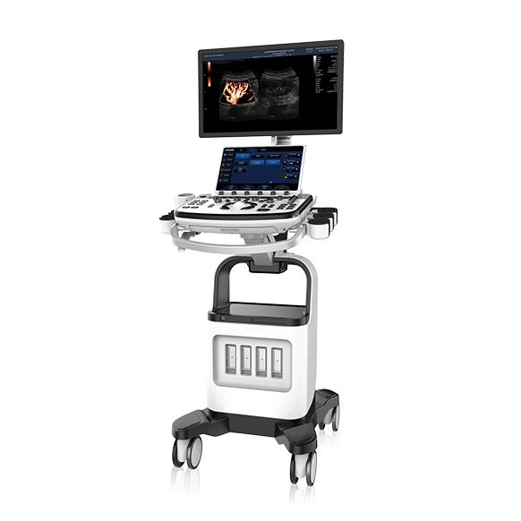 CHISON XBit 90- A New Experience in Console Ultrasound