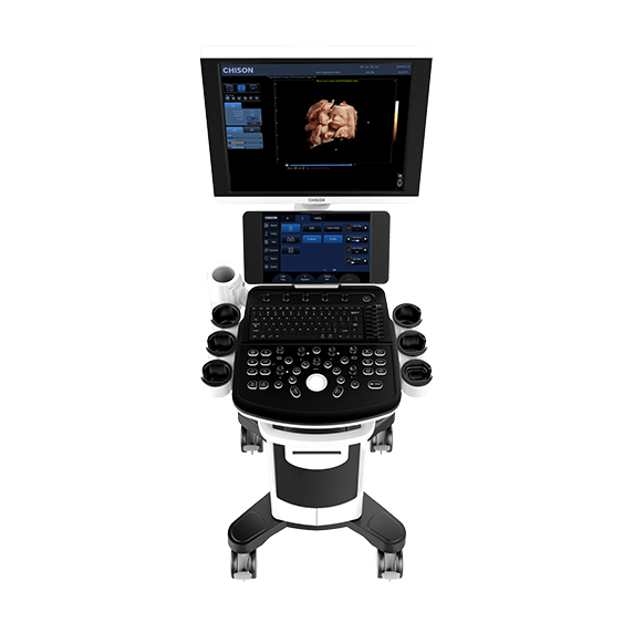 Portable Ultrasound Cart