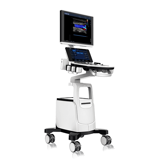 4D Color Doppler Ultrasound